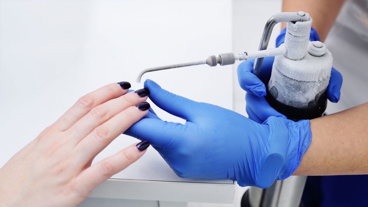 Cryosurgery Treatment Methods - Cryogen